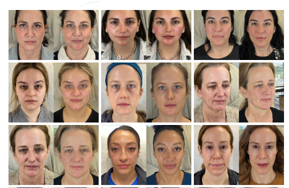 Photo Gallery | Face IQ Aesthetics | HOUSTON, TX